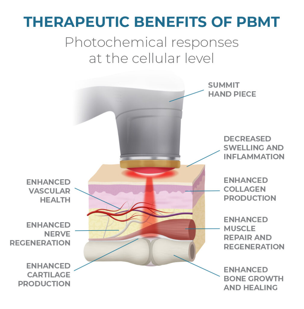 Photobiomodulation Laser Therapy - Ashmore Osteopathic GroupAshmore ...